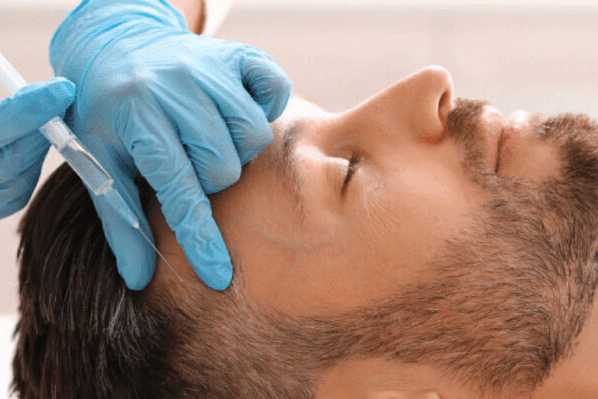 How PRP Therapy Uses Your Own Plasma to Combat Hair Loss - Aestheticaa